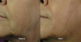 Skin Revitalization Orlando, FL | Gentle Touch MediSpa